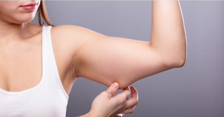 How To Lose Arm Fat Without Exercise - Metrolina Medical Associates